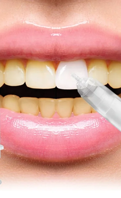 Teeth Whitening Gel Pen – Jalia walda